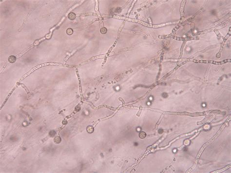 Tamu Plpa631 Fungalblog Lornanissen Lab 6