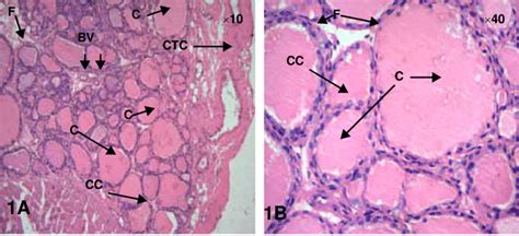 A And 1b Control Thyroid Gland Sections 1a ×10 1b ×40 Showing The
