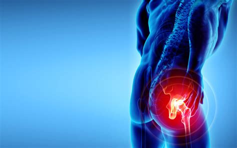 Avascular Necrosis Or Osteonecrosis Symptoms And Treatment Options
