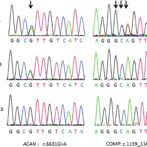 Mutation Identification Of Acan Gene And Comp Gene Electropherogram