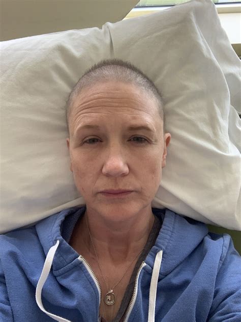 8 Iv Chemo Treatments 2 Weeks Apart — Young Ass Cancer