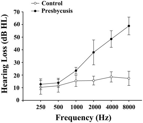 Average Hearing Thresholds Of The Presbycusis And Control Groups The