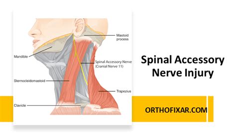 Spinal Accessory Nerve Injury Orthopedic Learning