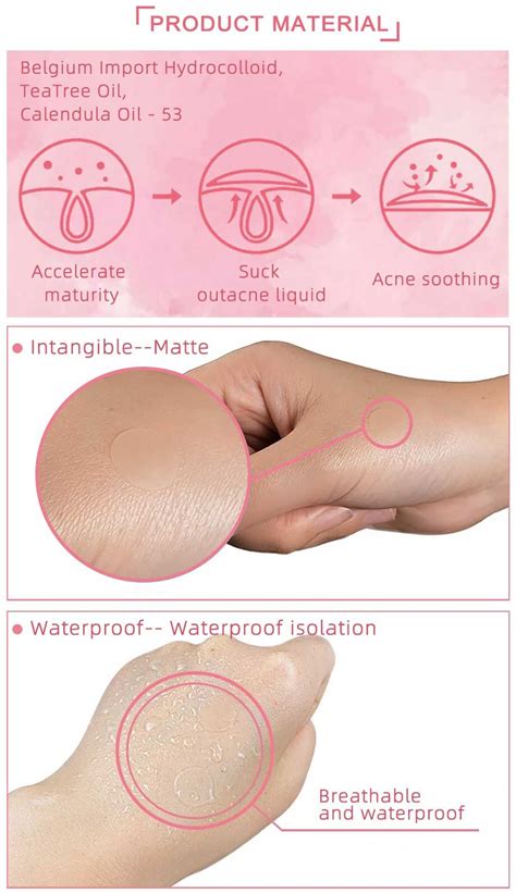Buy Wholesale China Hydrocolloid Acne Dots Acne Pimple Master Patch Spot Patch Acne Treatment