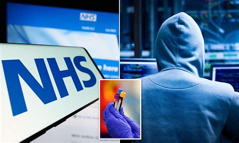 russia hackers that targeted major lab service provider for nhs demand