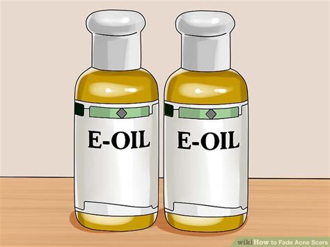 3 Ways To Fade Acne Scars WikiHow
