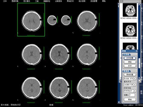 医学影像mri，ct和x Ray概述和成像原理编程编程的技术博客51cto博客