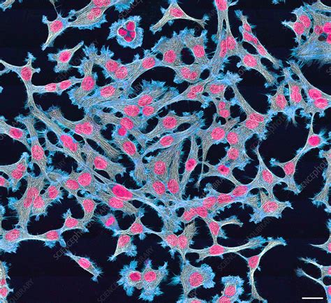 Hela Cells Fluorescence Light Micrograph Stock Image C060 3828 Science Photo Library