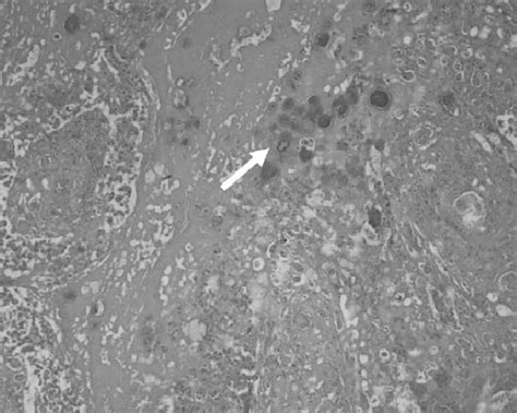 Microscopic Examination Of Intestine Revealed A Severe Fibrinonecrotic Download Scientific