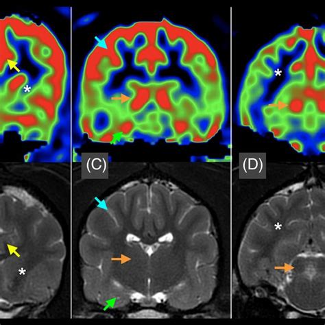 Good Diagnostic Quality Brain Asl Perfusion Images Gasl Pattern And Download Scientific