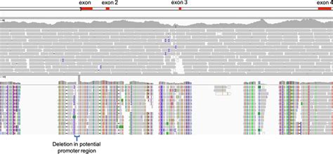 Dna Sequence Polymorphisms In Ftl1 Gene Illumina Reads From P Top
