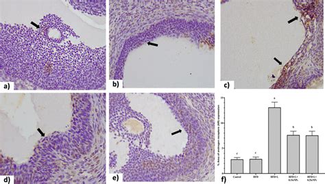 Microscopic Images Show Effect Of Selenium Nanoparticles Senps On The