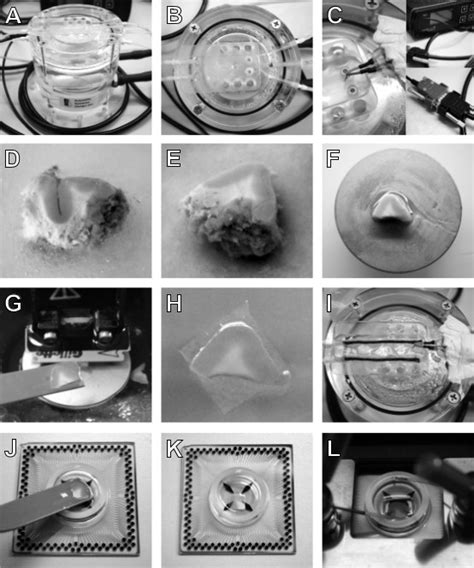 Multi Electrode Array Recordings Of Human Epileptic Postoperative