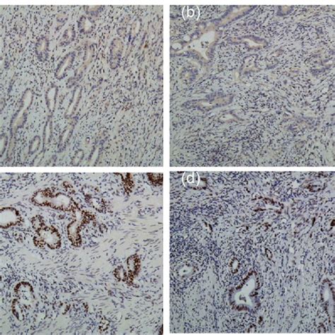 Ihc Examination Of Mmr Protein Expression In Tumor Sections Ihc