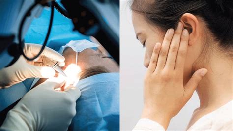 Akibat Tabiat Melampau Teman Lelaki Pecah Gegendang Telinga Wanita Ini