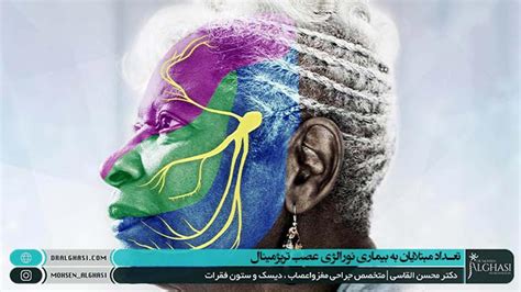 نورالژی عصب سه قلو تری ژمینال دکتر محسن القاسی
