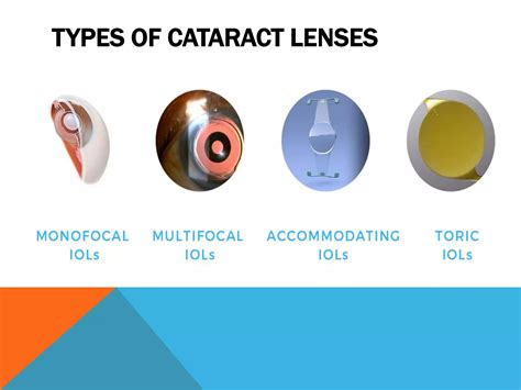 Different Types Of Cataract Lenses Pptx