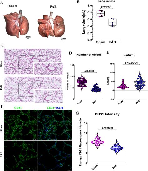 Pulmonary Hypoperfusion Caused Alveolar Dysplasia At Postnatal Day 21