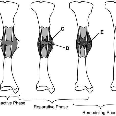 Structure Of A Typical Fracture Healing Simulation Initially A Model