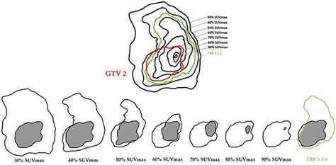 Simplified Schematic Representation Of Comparison Of Tumor Volumes On