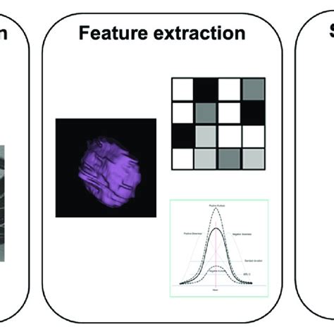 Ovarian Cancer Radiomic Workflow Image Segmentation Ovarian Cancer