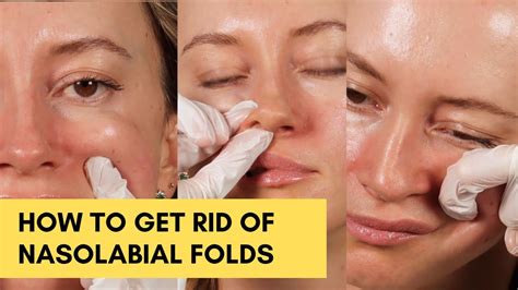 Amazing Massage To Get Rid Of Nasolabial Folds At Home Youtube