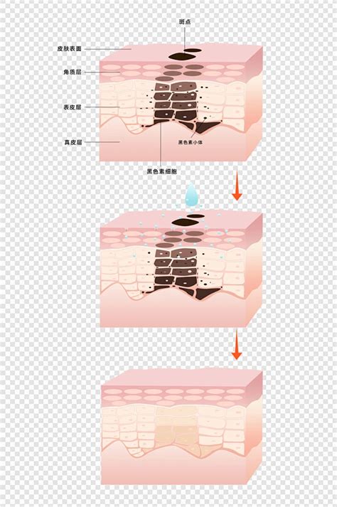3d立体皮肤层次淡化色斑免扣元素 花瓣网