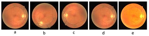 Ht Net A Hybrid Transformer Network For Fundus Vessel Segmentation