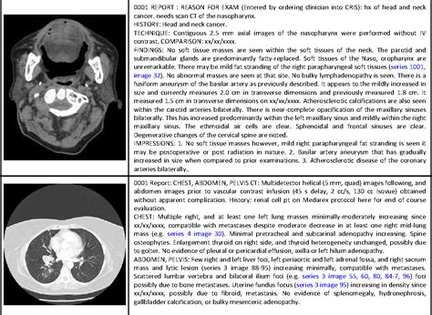 Figure 1 From Interleaved Textimage Deep Mining On A Large Scale Radiology Database For