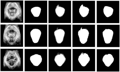 The First And Second Columns The Original Levator Hiatus Ultrasound Download Scientific
