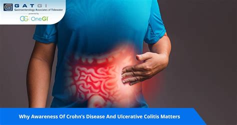 The Crucial Importance Of Crohns Disease And Ulcerative Colitis