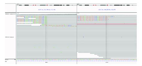 Ngs Indicated A Somatic Mutation Somatic Brca1 Exon 17 18 Inv