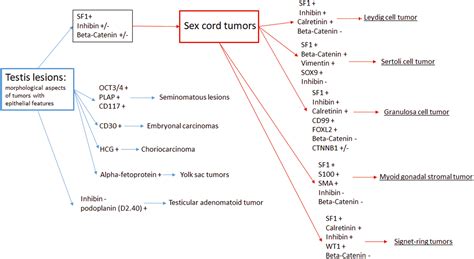 Leydig Sertoli Collision Sex Cord Stromal Tumor Of The Testis A Case Report Of An Unusual