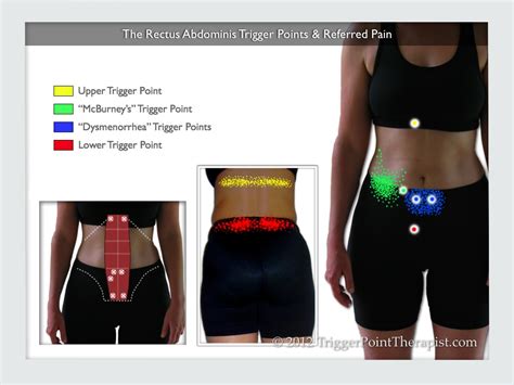 Rectus Abdominis Trigger Points A Six Pack Of Deception