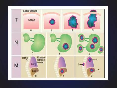 Clinical Aspects Of Neoplasia Pptx