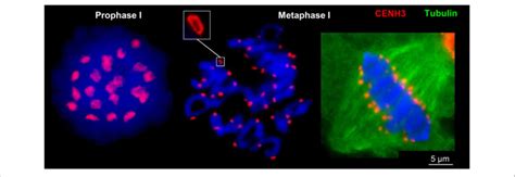 Cenh3 Positive Centromere Structures During Meiosis Of Hexaploid Download Scientific Diagram