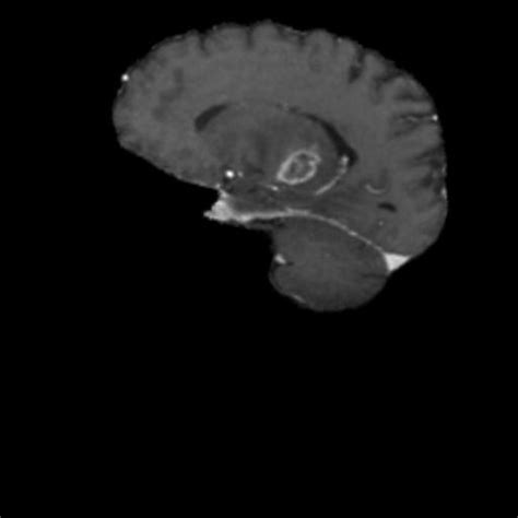 Mmenendezg Brain Tumor Object Detection · Datasets At Hugging Face