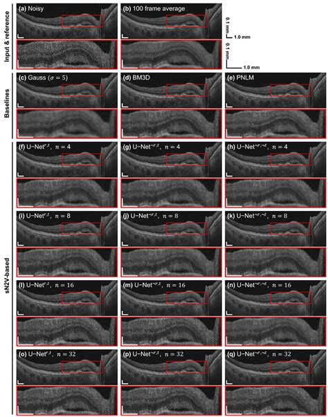 example for 2d denoising of a b scan from the evaluation dataset based