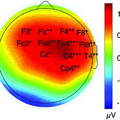 spline interpolated iso voltage scalp maps of the subtractions at each