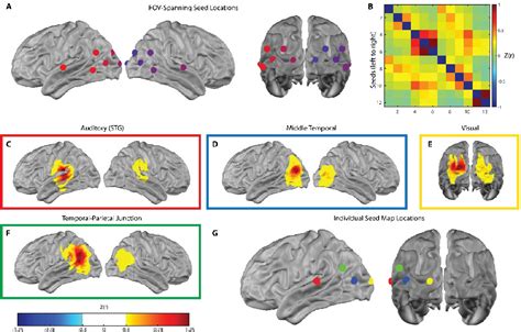 Figure 35 From High Density Diffuse Optical Tomography During Passive Movie Viewing A Platform