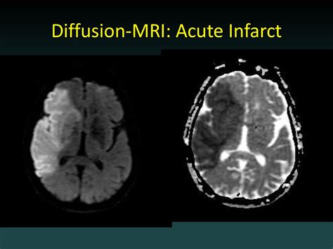Introductory Neuroimaging What You Need To Know At 3 Am And Some Cool Stuff Online Presentation