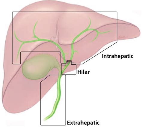 Classification Of Cholangiocarcinoma Download Scientific Diagram