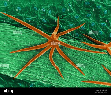 Hibiscus Sp Coloured Scanning Electron Micrograph Sem Leaf Underside With An Elaborate