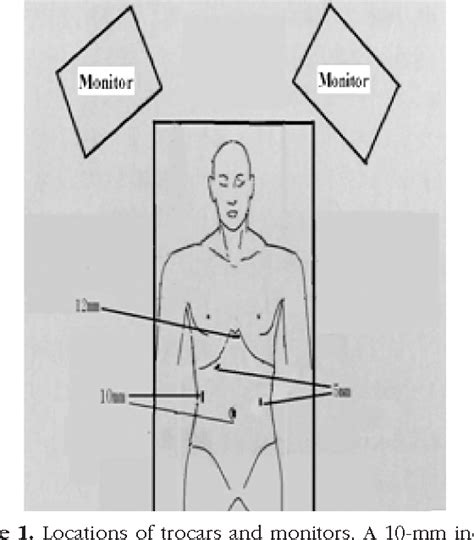 Choledochojejunostomy Semantic Scholar