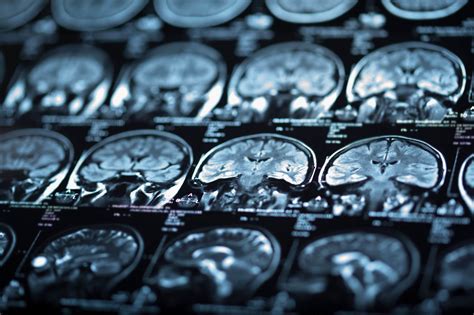 Alberta Health Services Diagnostic Imaging Request Form