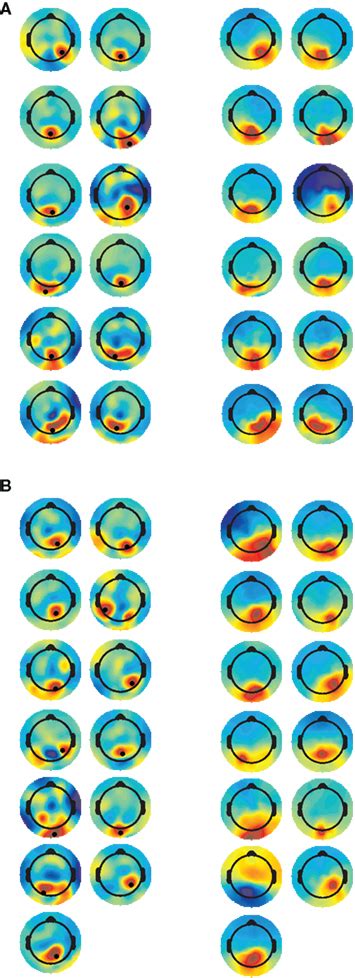Current Source Density Csd And Ic Scalp Maps Csd Maps Left Panel Download Scientific