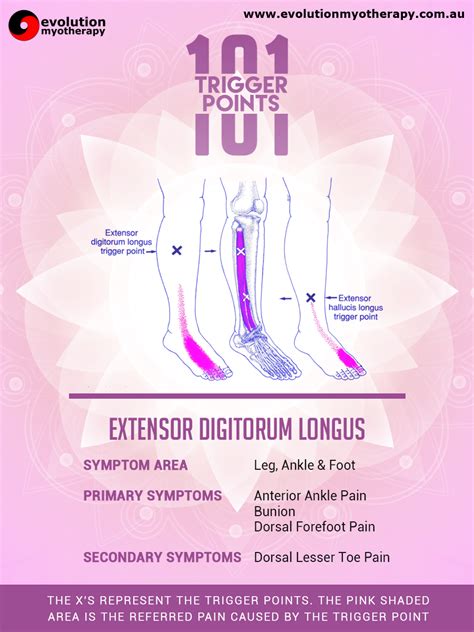 Trigger Points 101 Extensor Digitorum Longus