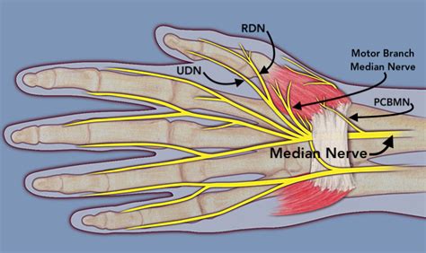 Palmar Cutaneous Branch Of The Median Nerve Anatomic Structures At Risk