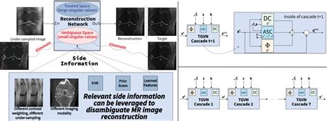 논문 리뷰 A Trust Guided Approach To Mr Image Reconstruction With Side Information