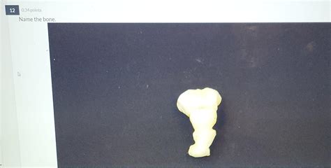 Solved 7 0 33 Points Name The Bone Marker At The Tip Of The